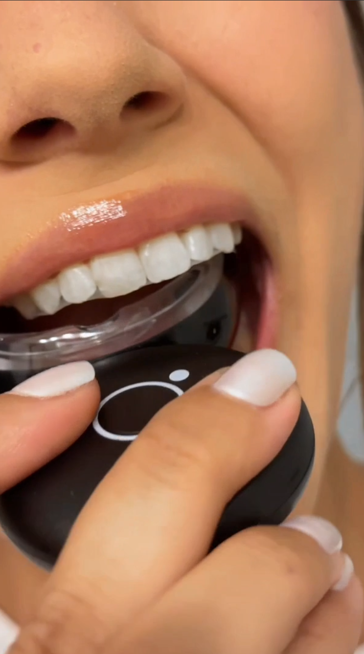 MOON Teeth Whitening Device – Moon Oral Care
